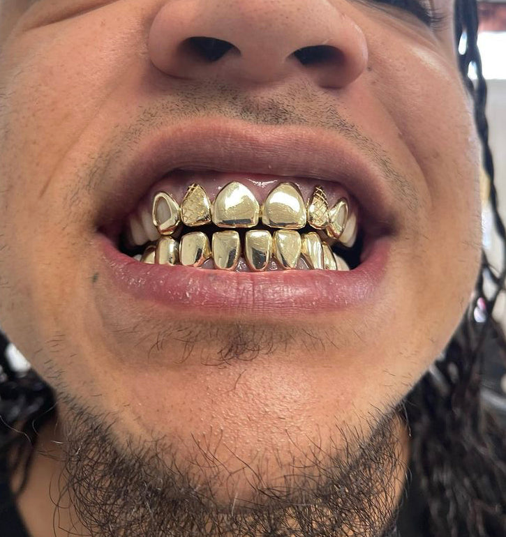 Dental gold/NPG per tooth – Gold2ink
